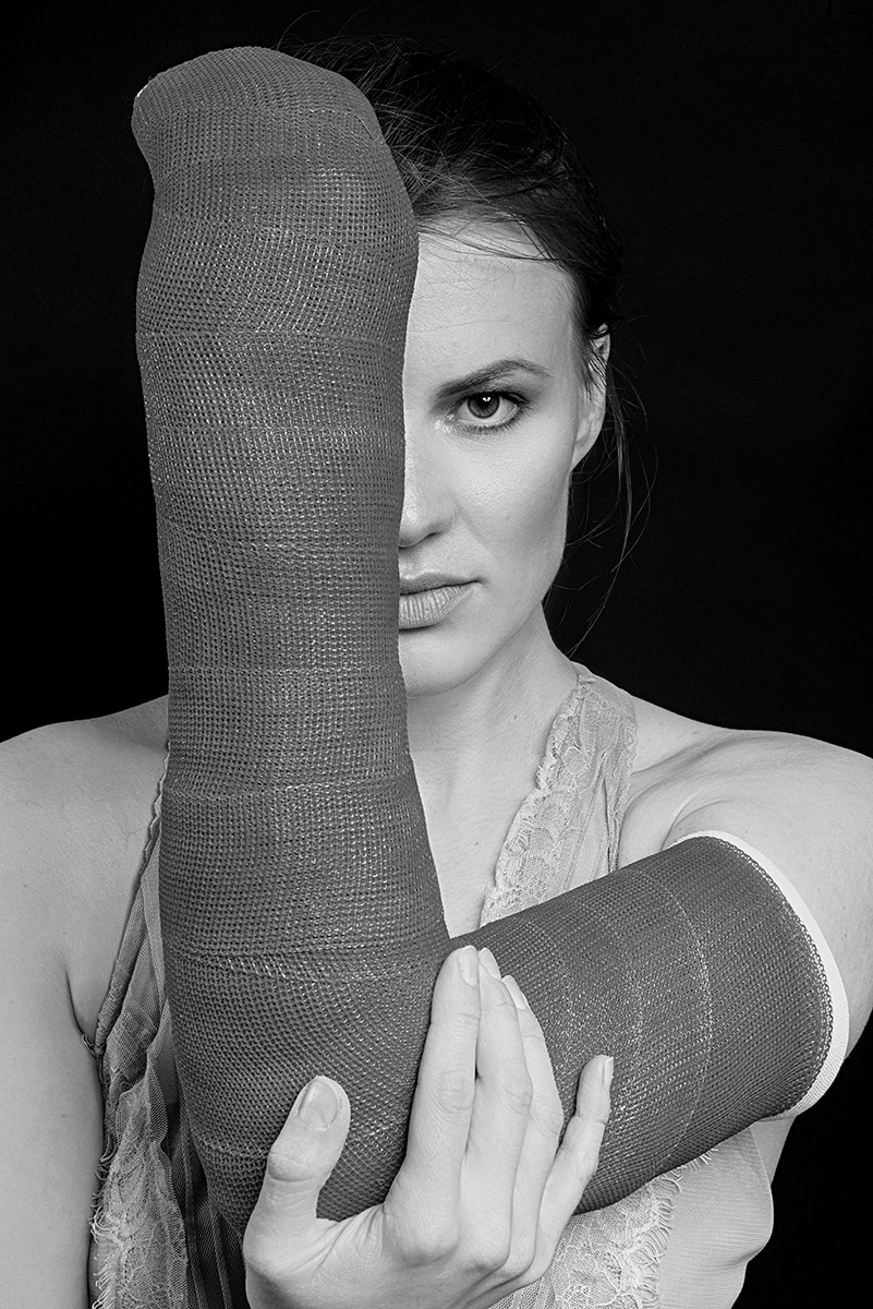 Broken Body Serie - "Esther, Gipsarm" (Download) - Erik Schlicksbier